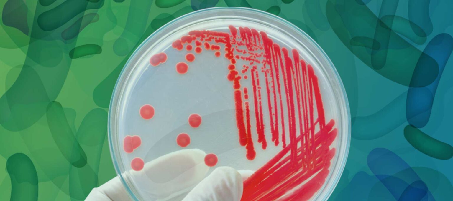 Your Guide to a Bacterial Colony - Hudson