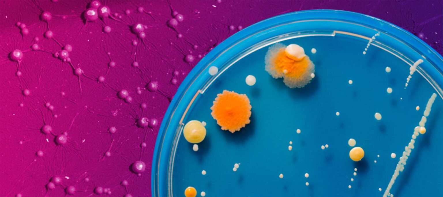Colony Morphology: What & How to Identity - Hudson