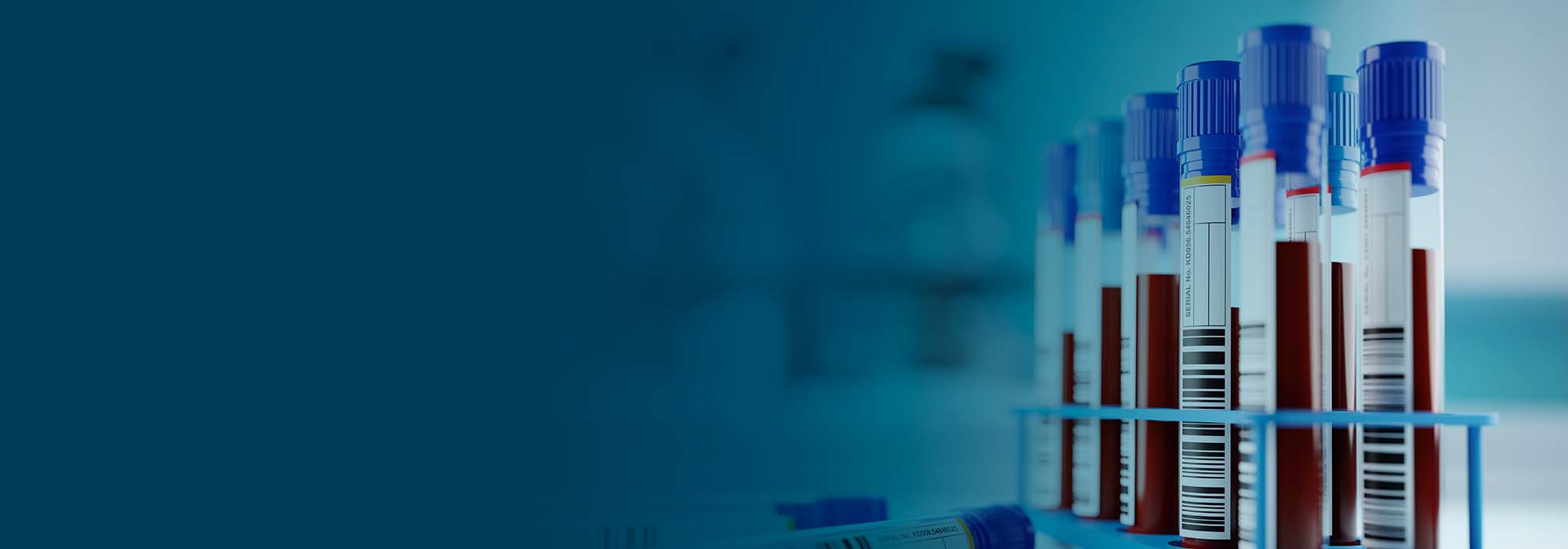 HLA Tissue Typing - Hudson